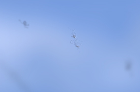 The laser beam that can get rid of those pesky eye floaters - EconoTimes