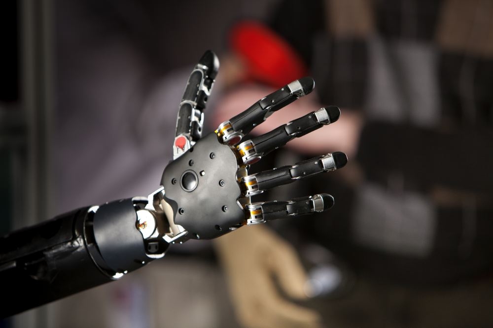 Scientist Creates Prosthetic Arm Where All Five Fingers Can Move ...